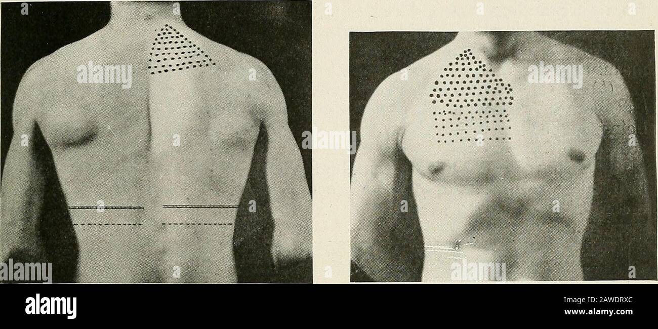 Diseases of the chest and the principles of physical diagnosis ...