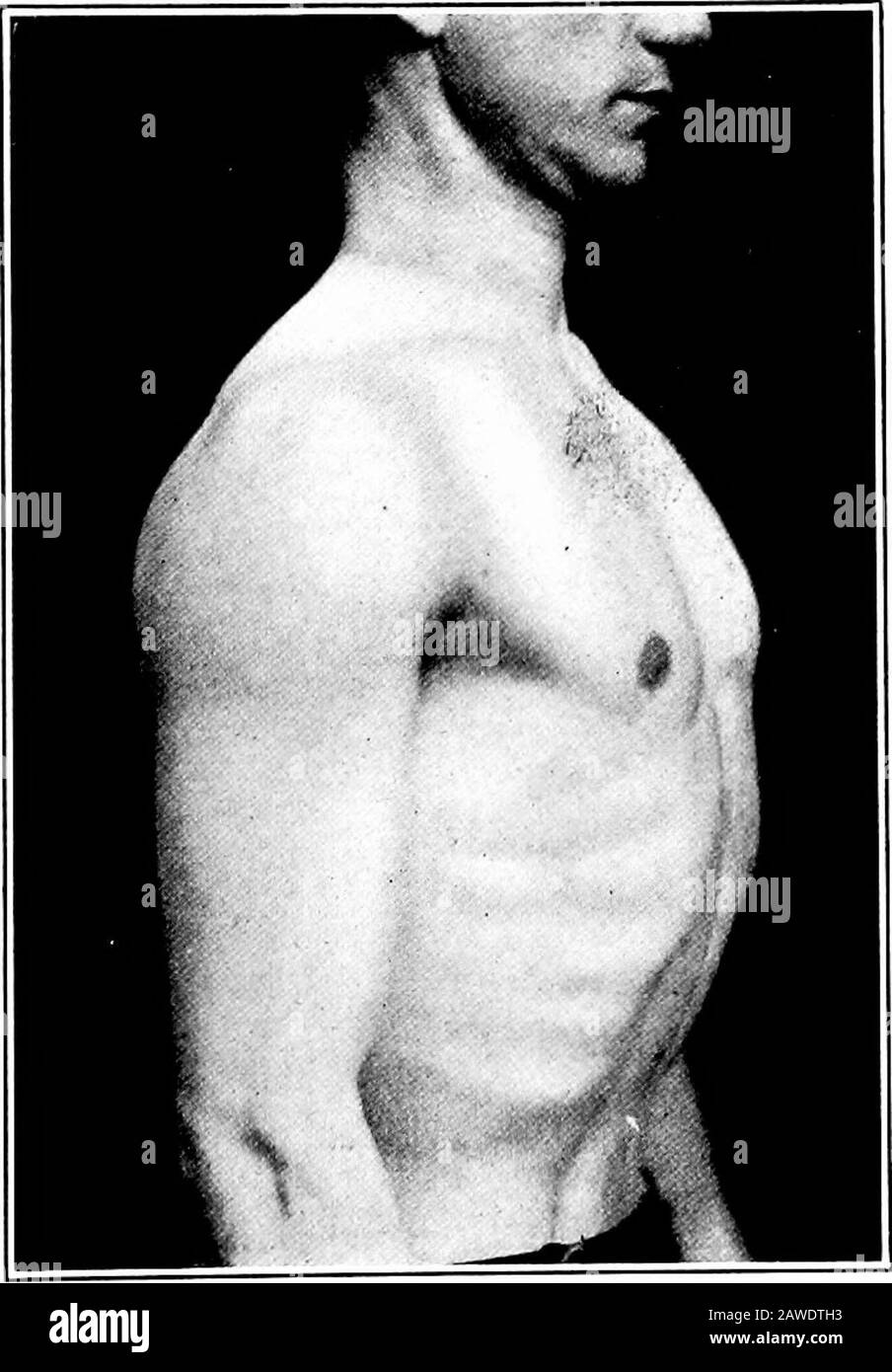 Applied anatomy and kinesiology, the mechanism of muscular movement ...