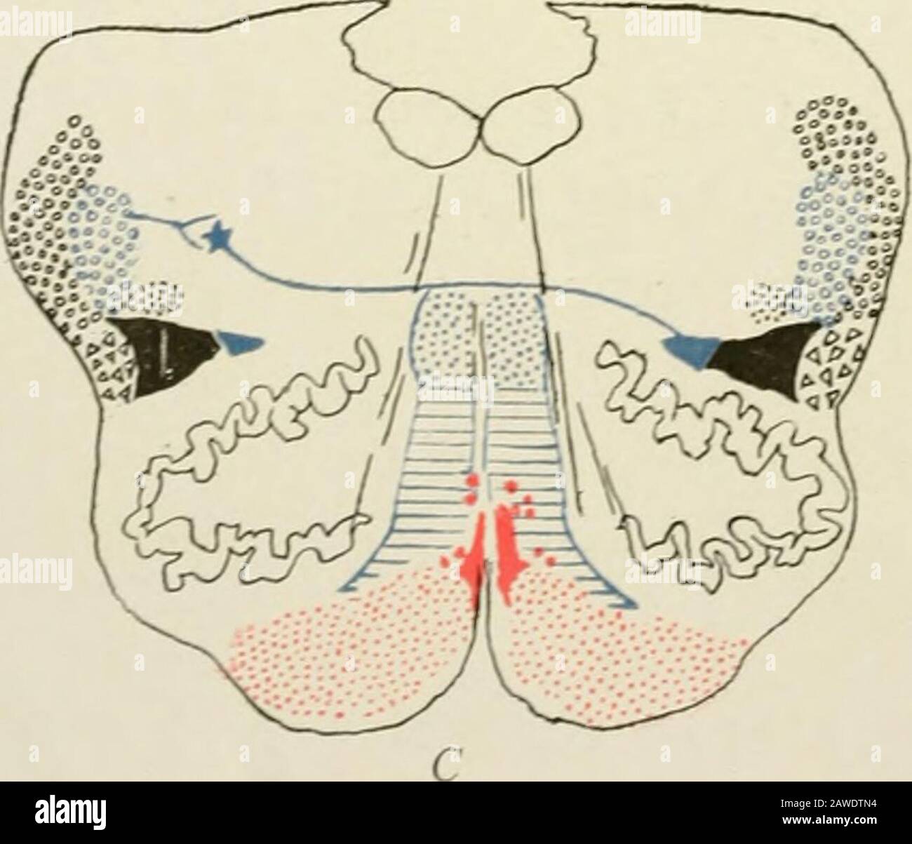 Medial Lemniscus Medulla