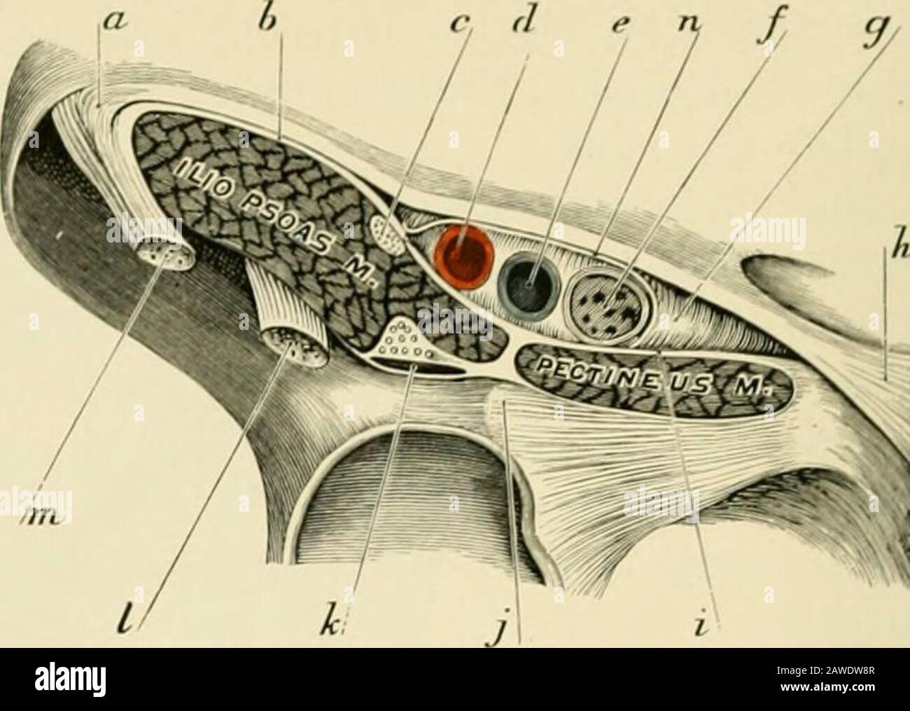 Operative surgery . Fig. 1116.—Direct inguinal her-nia, a. Integument ...