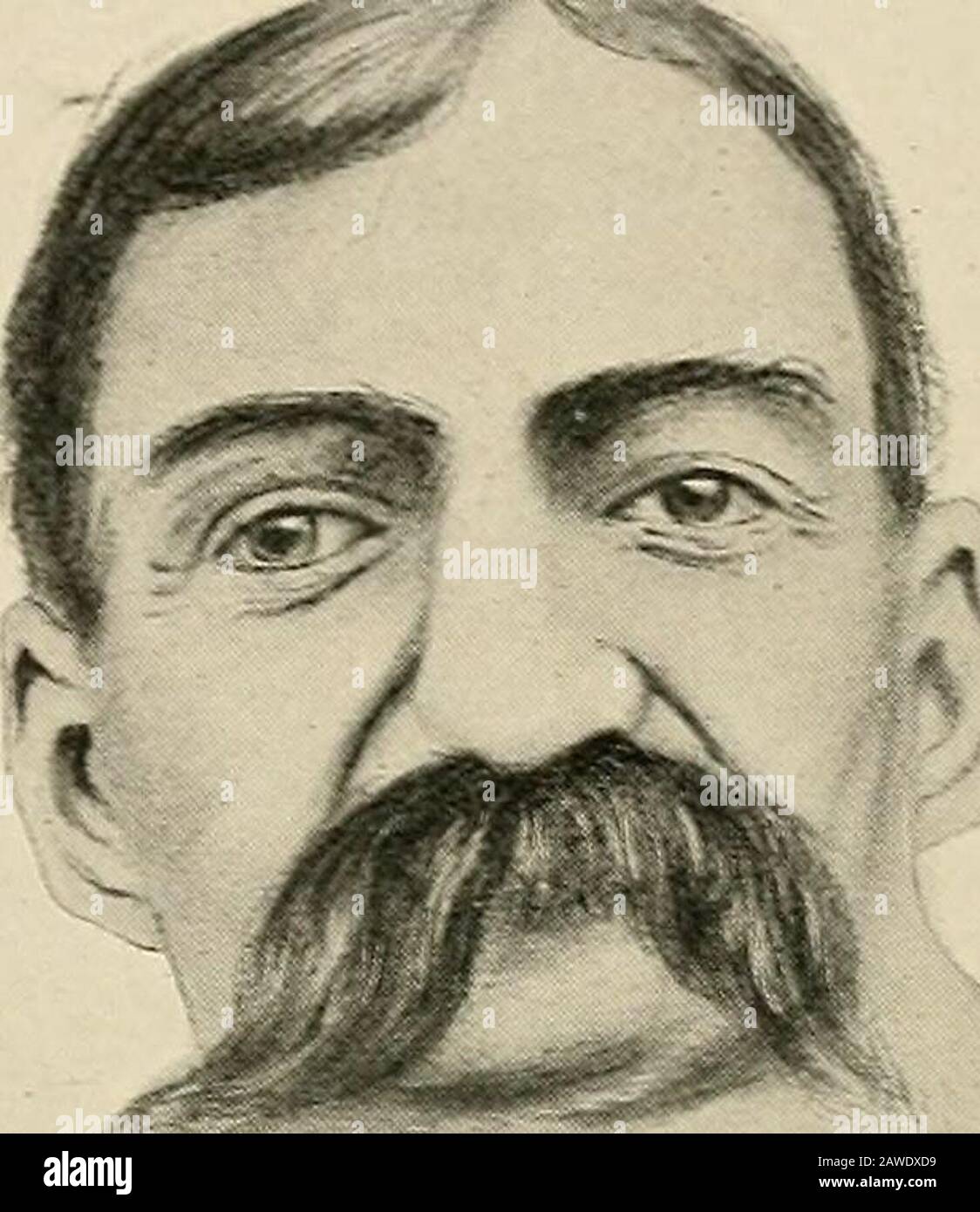 The practice of surgery . be the external ap-pearances of goiter ...