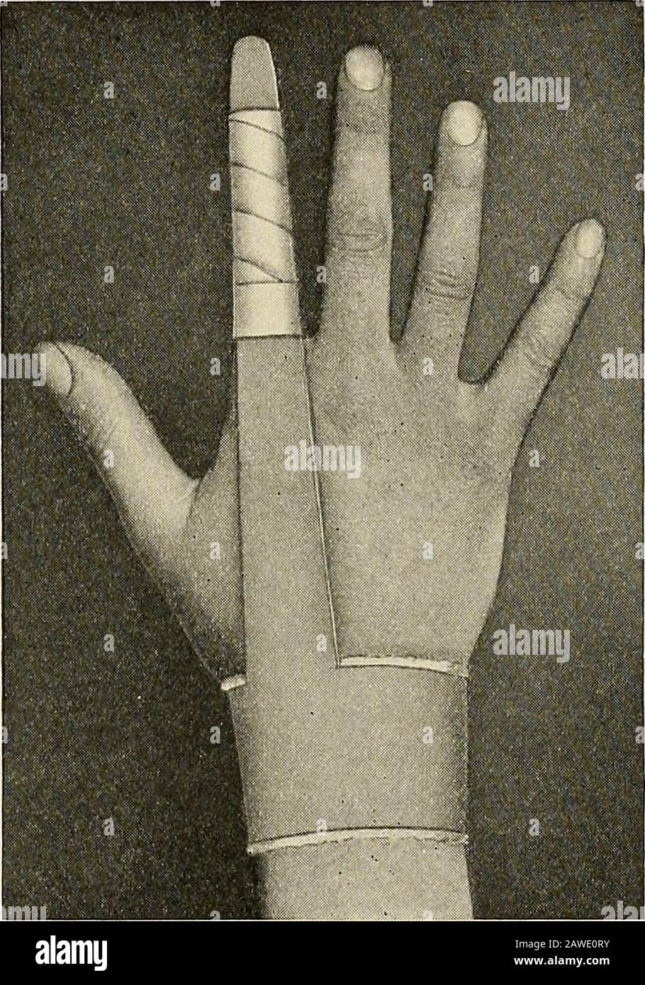 Sts operation hi-res stock photography and images - Alamy