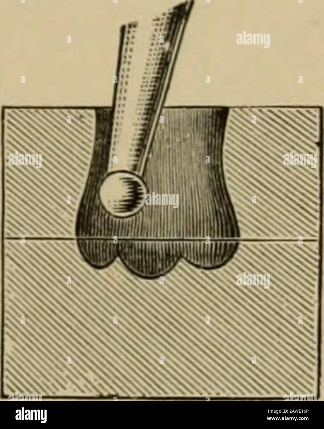 Dental crown fitting hi-res stock photography and images - Alamy