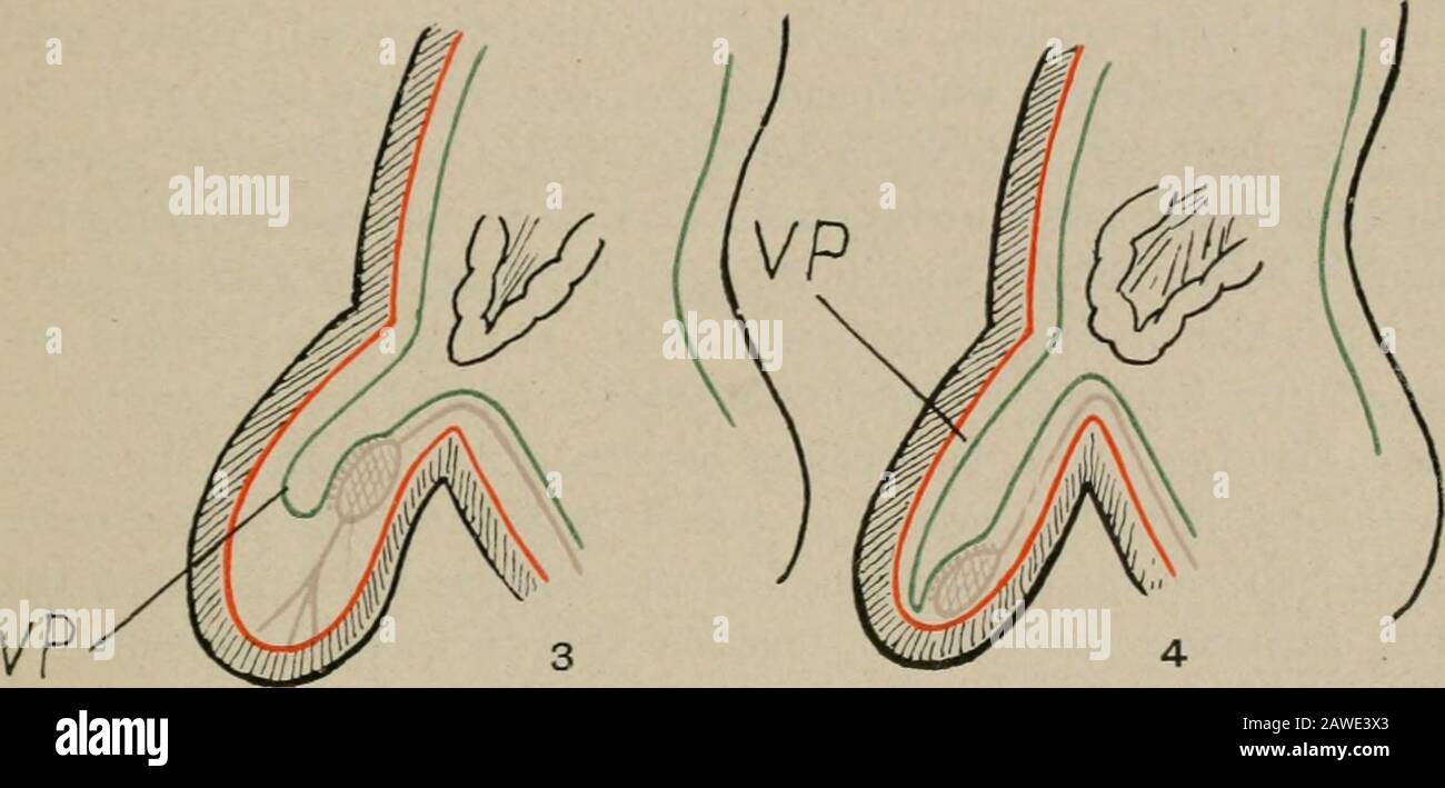 Operative surgery, for students and practitioners Stock Photo - Alamy