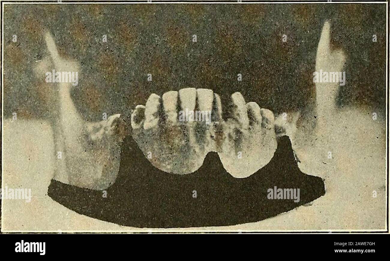 Oral destruction hi-res stock photography and images - Alamy