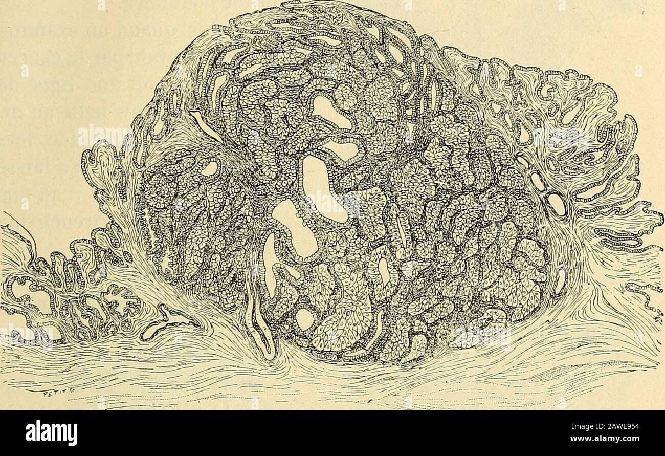 Cellules de carcinome hi-res stock photography and images - Alamy