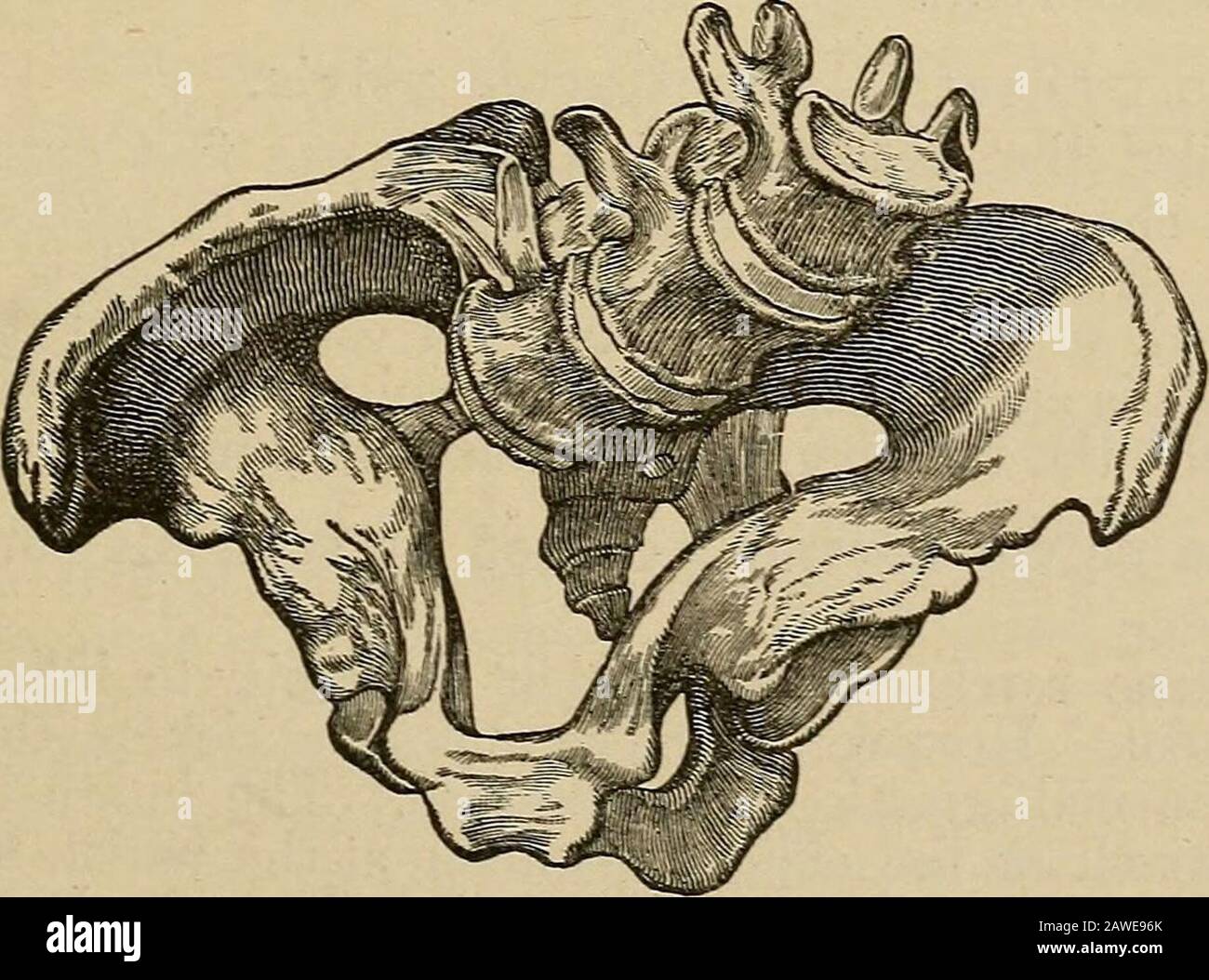 ObstetricsA manual for students and practitioners . Rachitic Pelvis ...