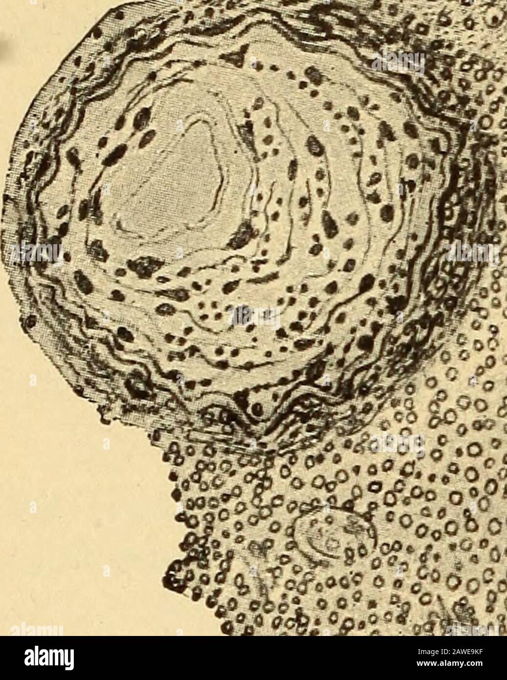 Syphilis study hi-res stock photography and images - Alamy