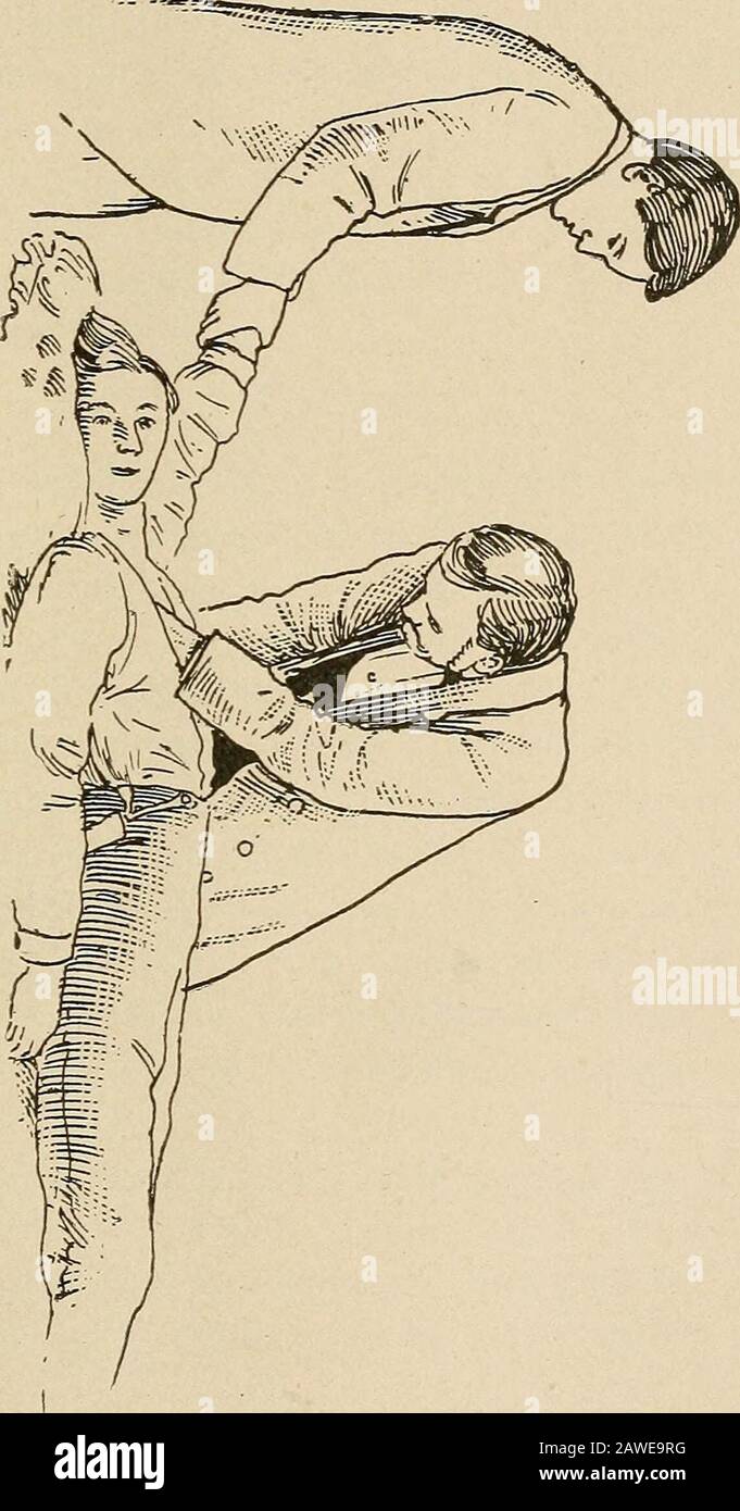 Tuberculosis test arm hi-res stock photography and images - Alamy