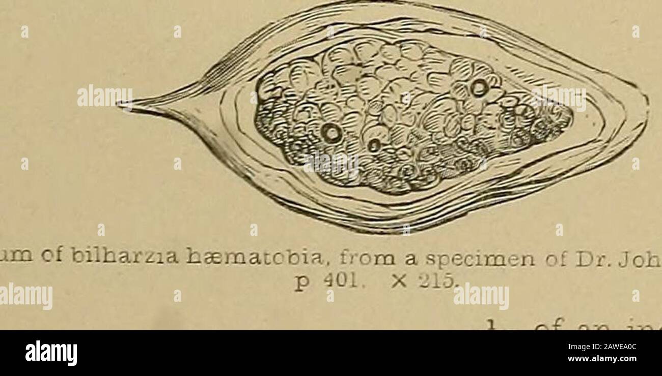 Kidney diseases, urinary deposits, and calculous disorders : their ...