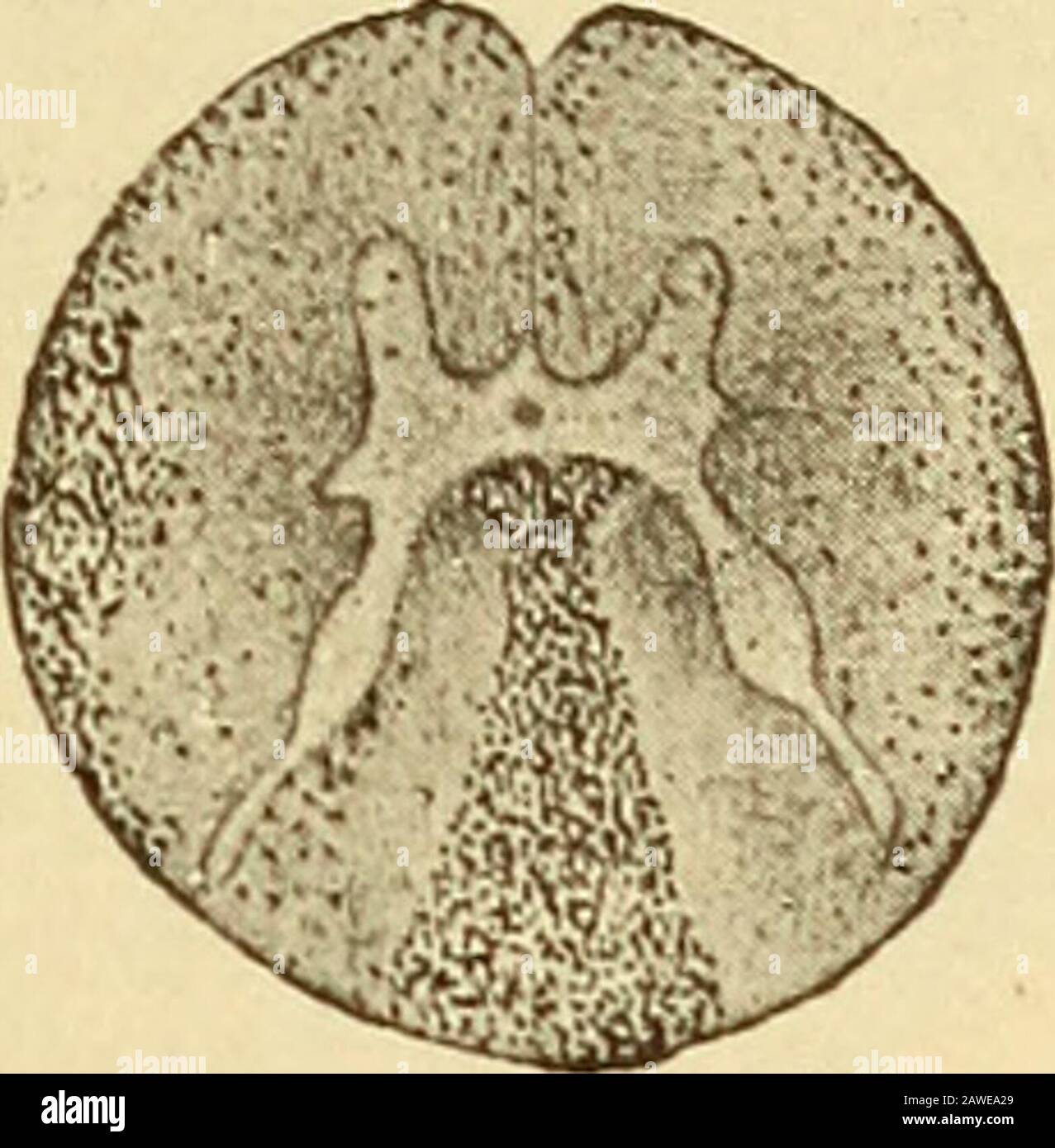 Lateral lemniscus hi-res stock photography and images - Alamy