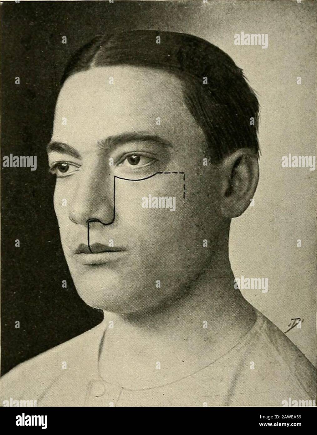 Ether anesthesia hi-res stock photography and images - Alamy