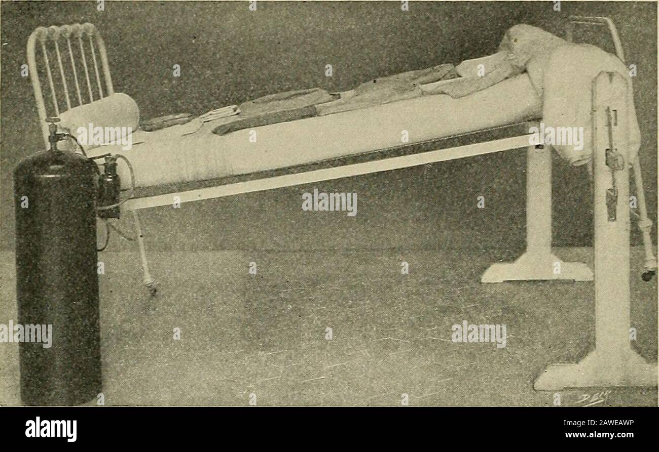 Vomitus hi-res stock photography and images - Alamy