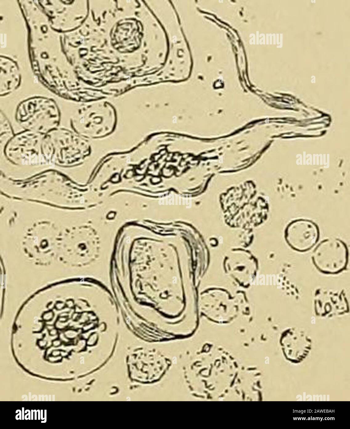Kidney diseases, urinary deposits, and calculous disorders : their ...