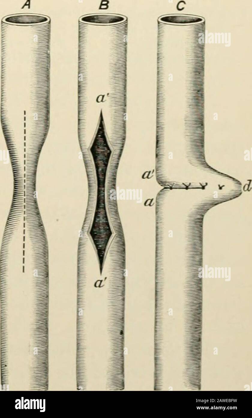 Operative surgery . n the catheter. The longitudinalincision was then ...