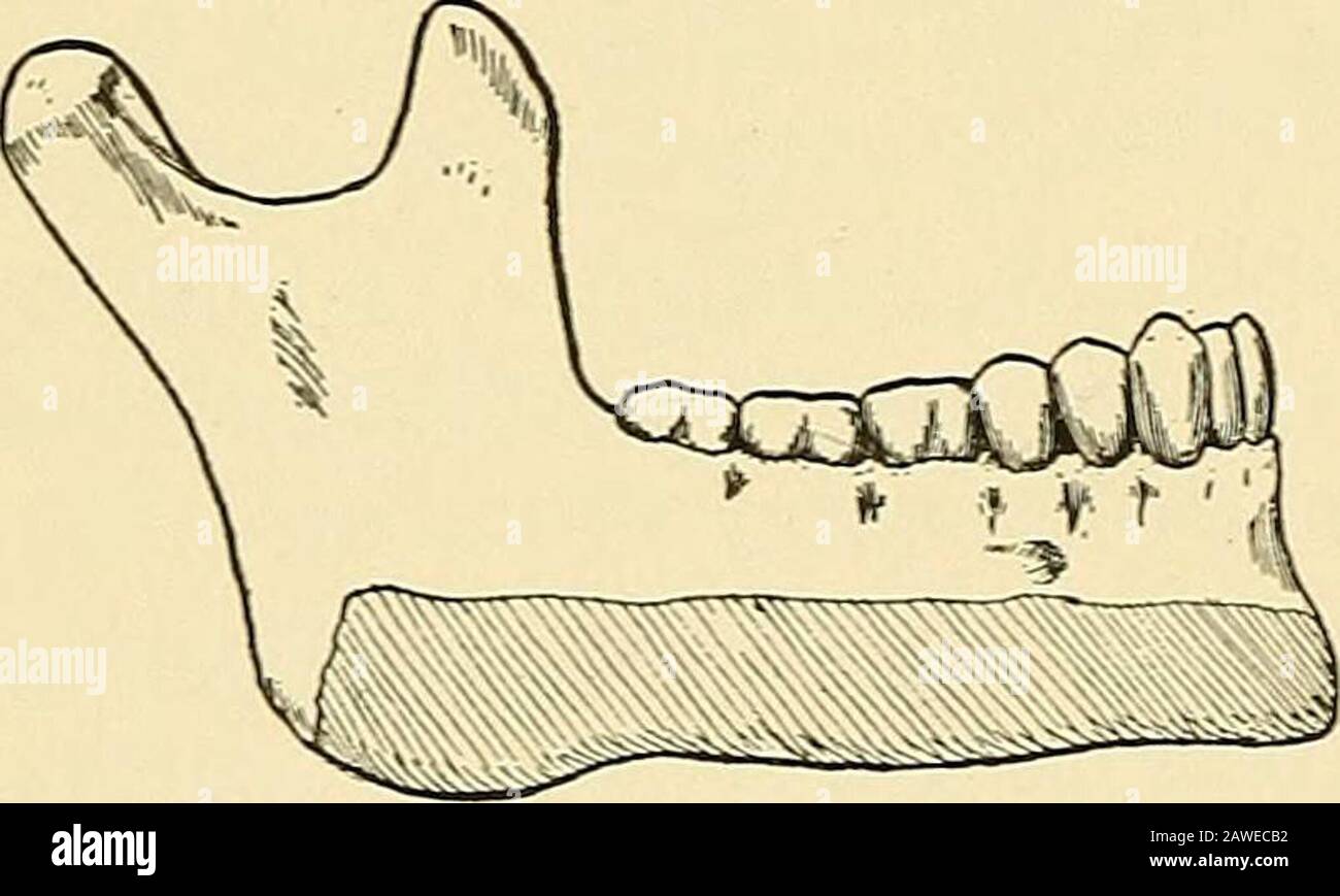 Oral surgery; a text-book on general surgery and medicine as applied to ...