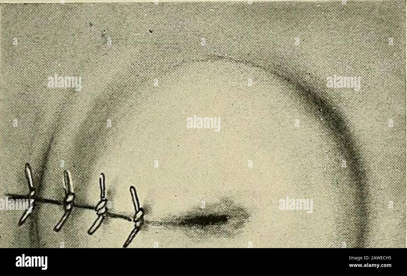 Fibr hi-res stock photography and images - Alamy