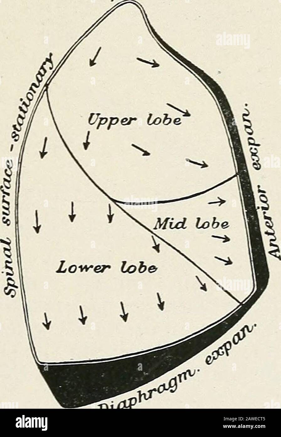 Unequal Chest Expansion