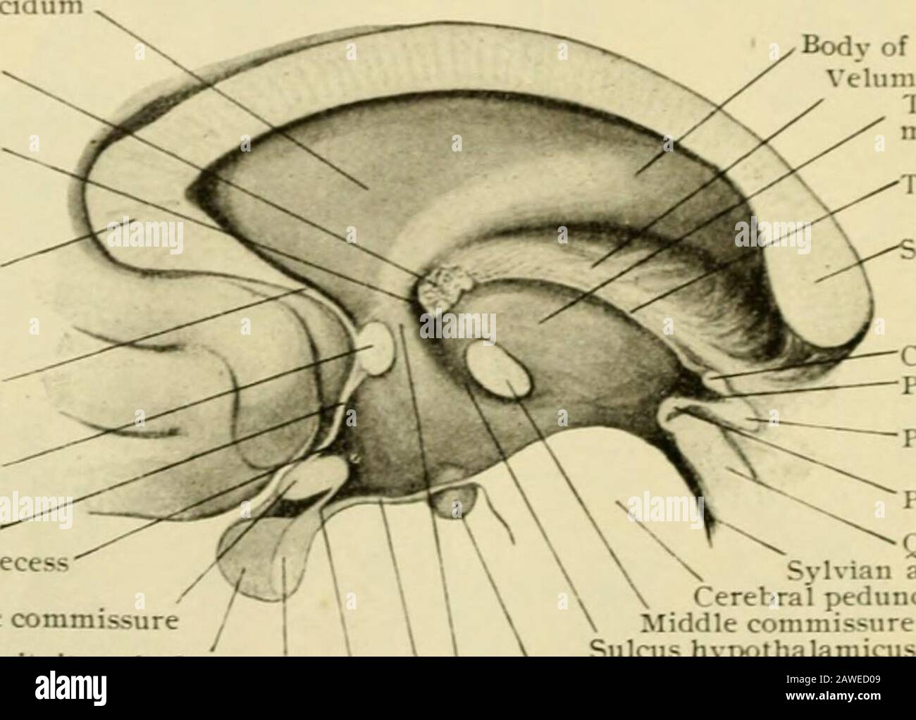 Subthalamic Nucleus Cross Section