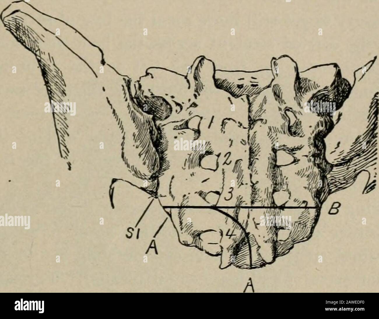 Posterior inferior iliac spine hi-res stock photography and images - Alamy