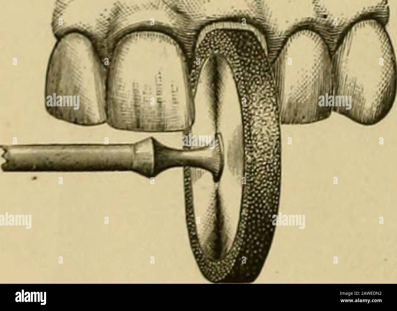 Annular joint hi-res stock photography and images - Alamy