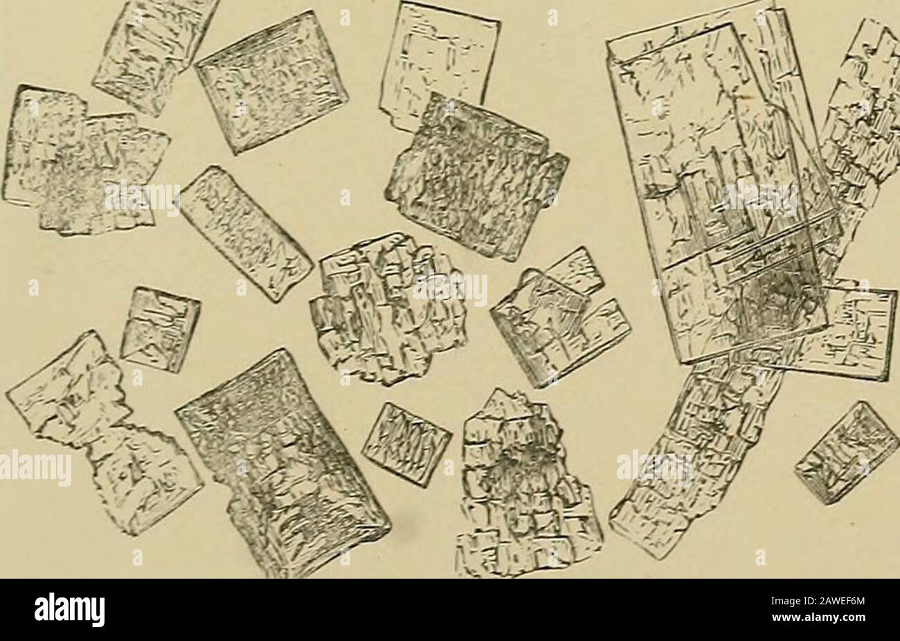 Kidney diseases, urinary deposits, and calculous disorders : their ...