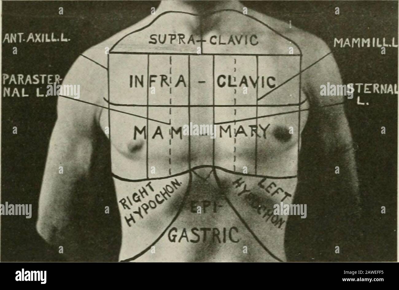 Diseases of the chest and the principles of physical diagnosis . t ...