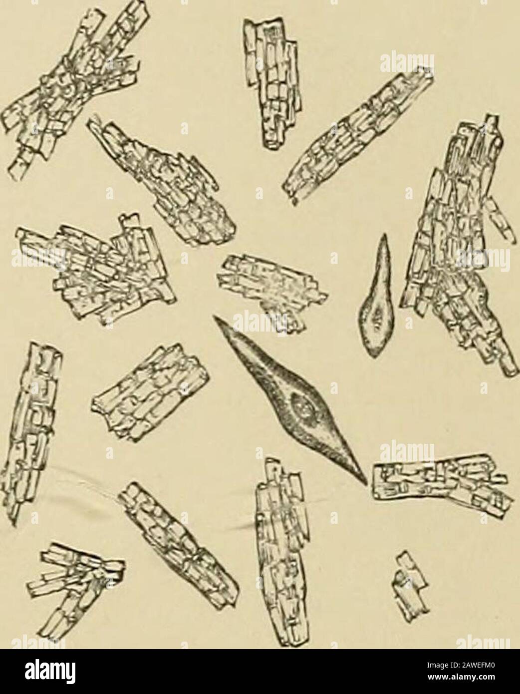 Kidney diseases, urinary deposits, and calculous disorders : their ...
