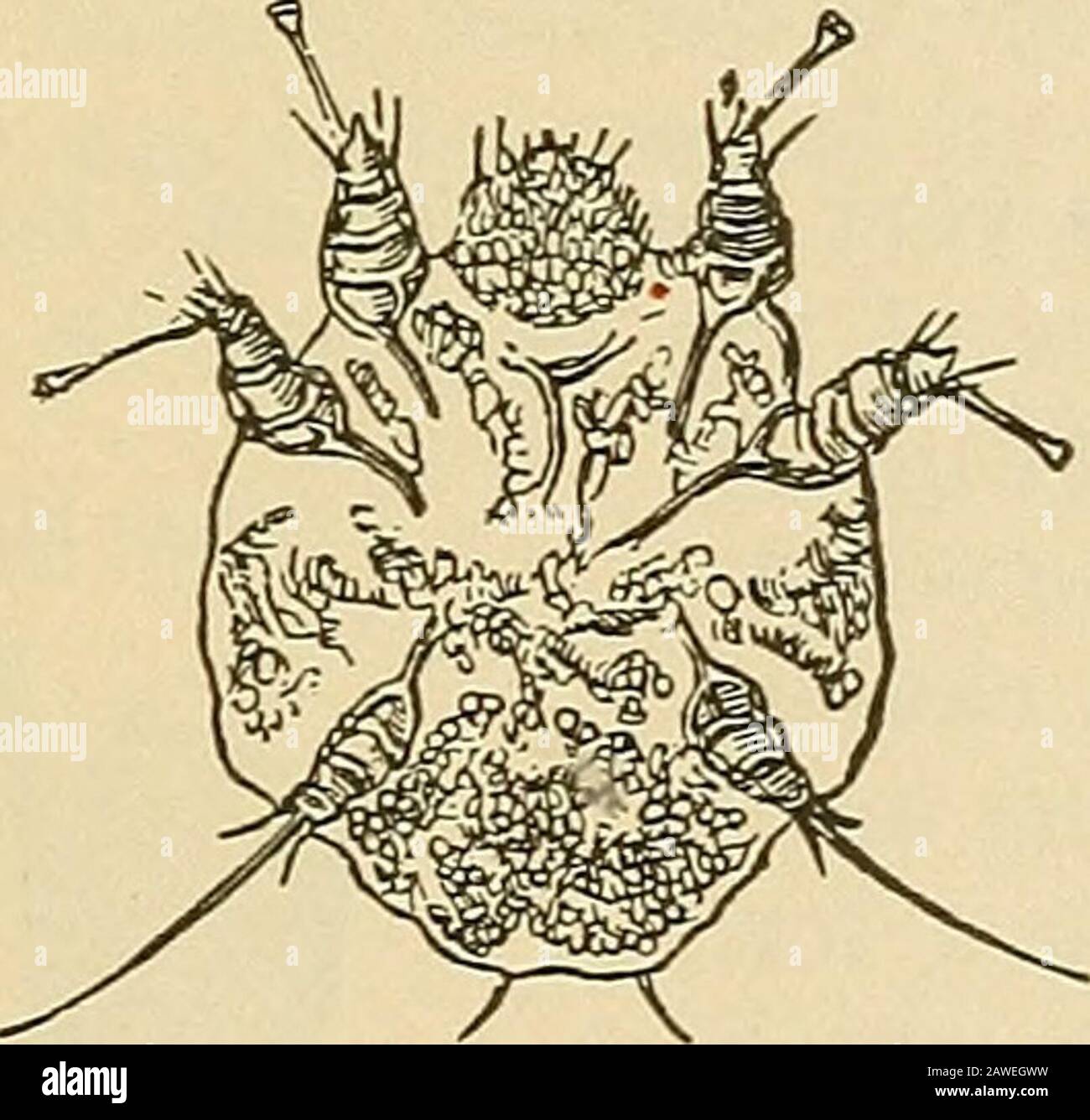 Scabies lesions hi-res stock photography and images - Alamy
