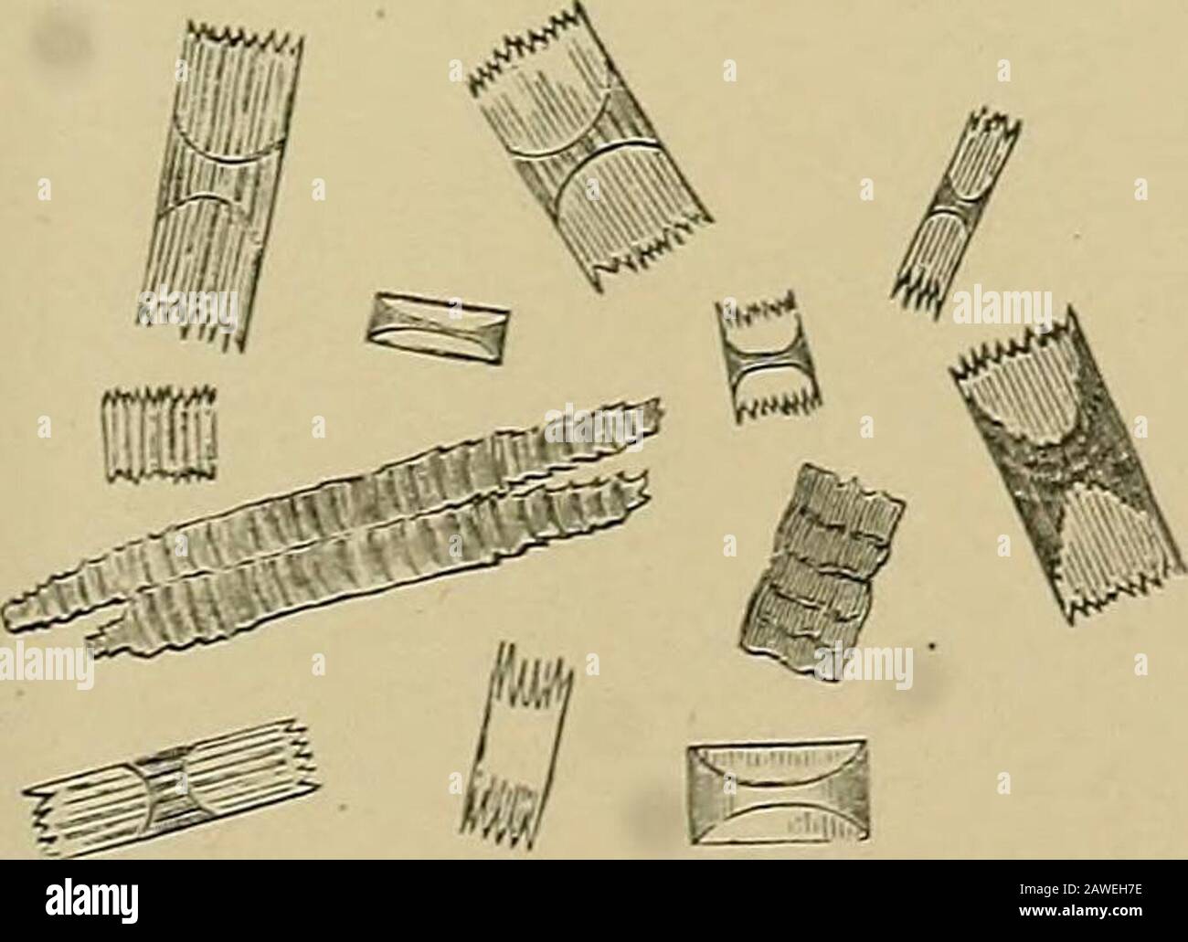 Kidney diseases, urinary deposits, and calculous disorders : their ...