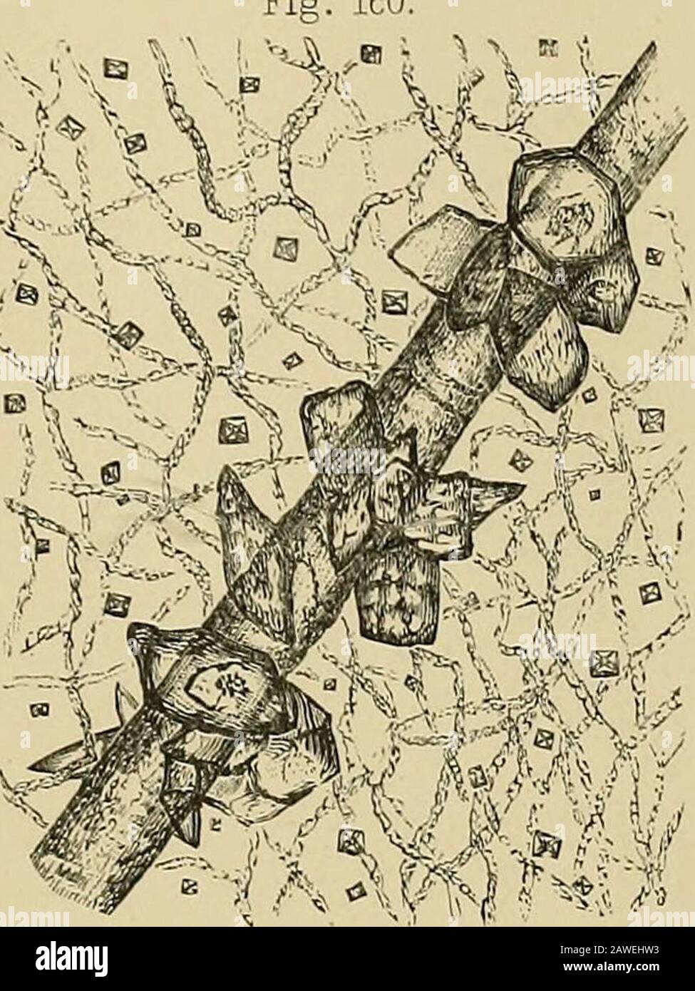 Kidney diseases, urinary deposits, and calculous disorders : their ...