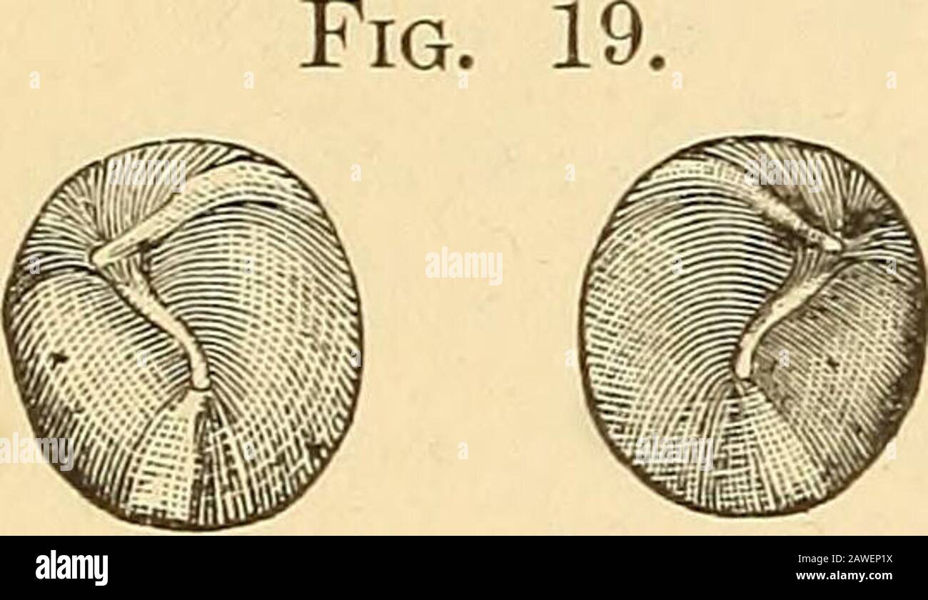 A text-book on diseases of the ear, nose and throat . Outer surface of ...