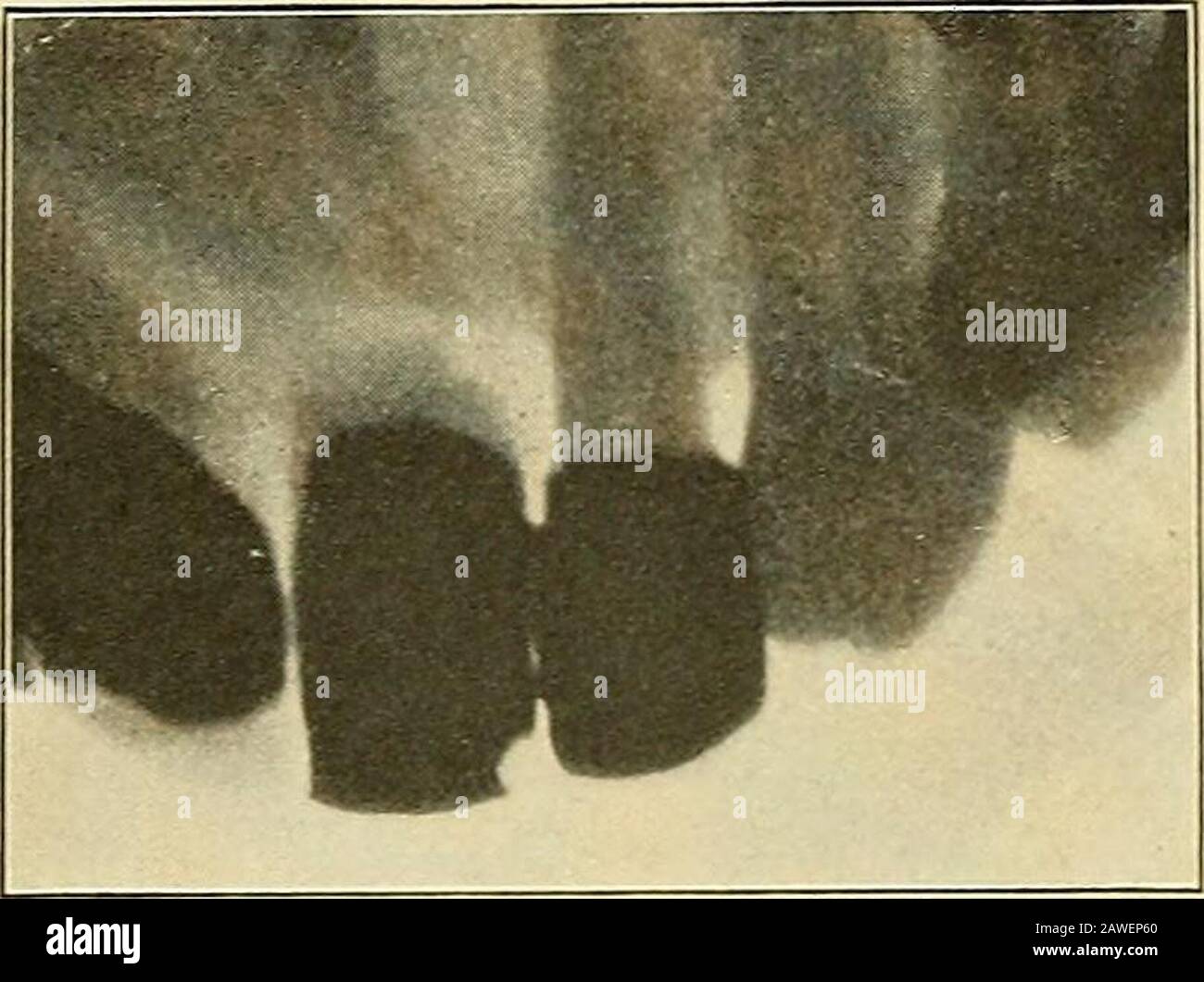 Oral surgery; a text-book on general surgery and medicine as applied to ...