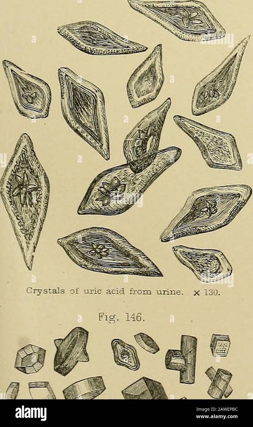 Kidney diseases, urinary deposits, and calculous disorders : their ...