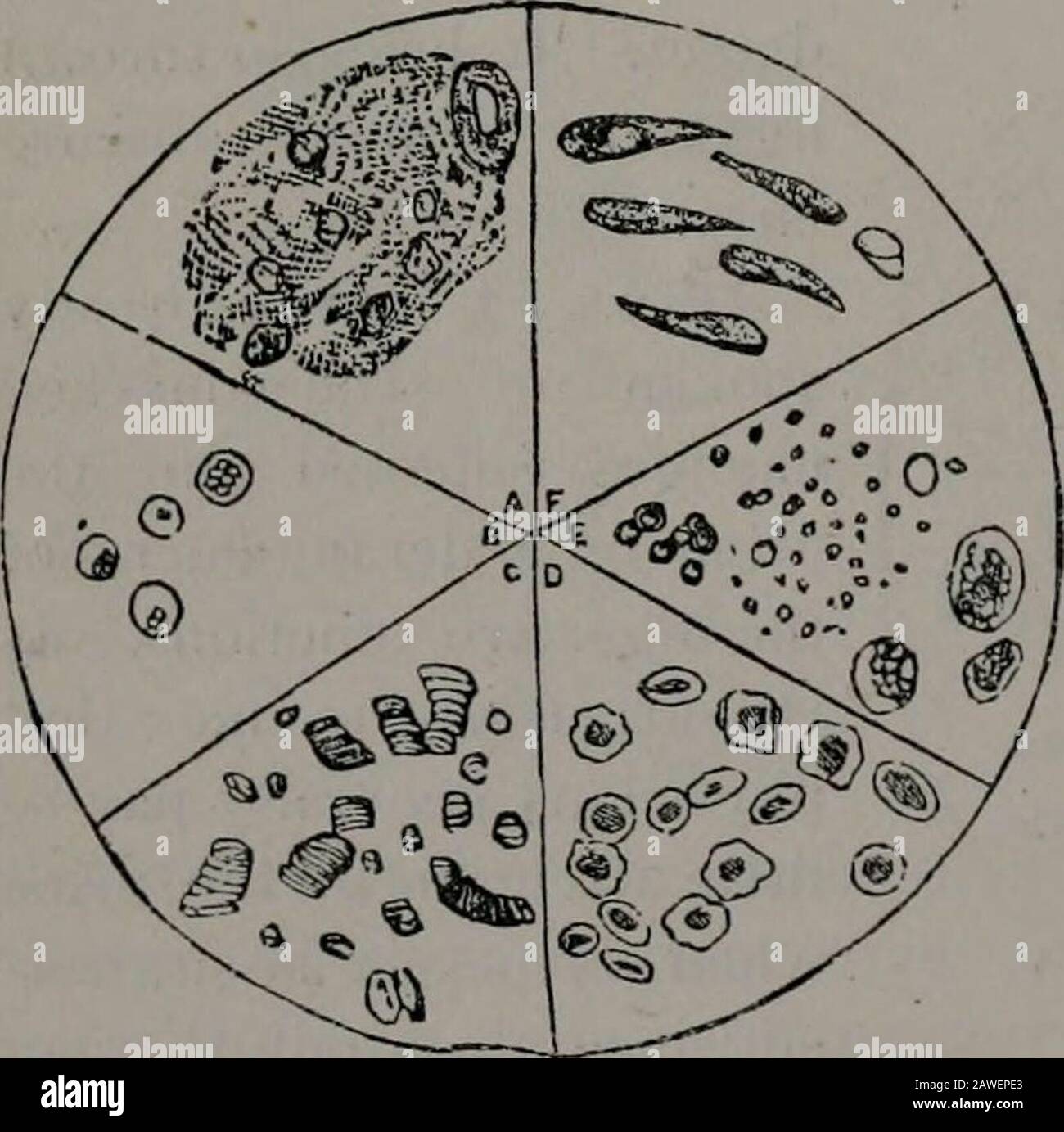 Crystals in the kidneys hi-res stock photography and images - Alamy
