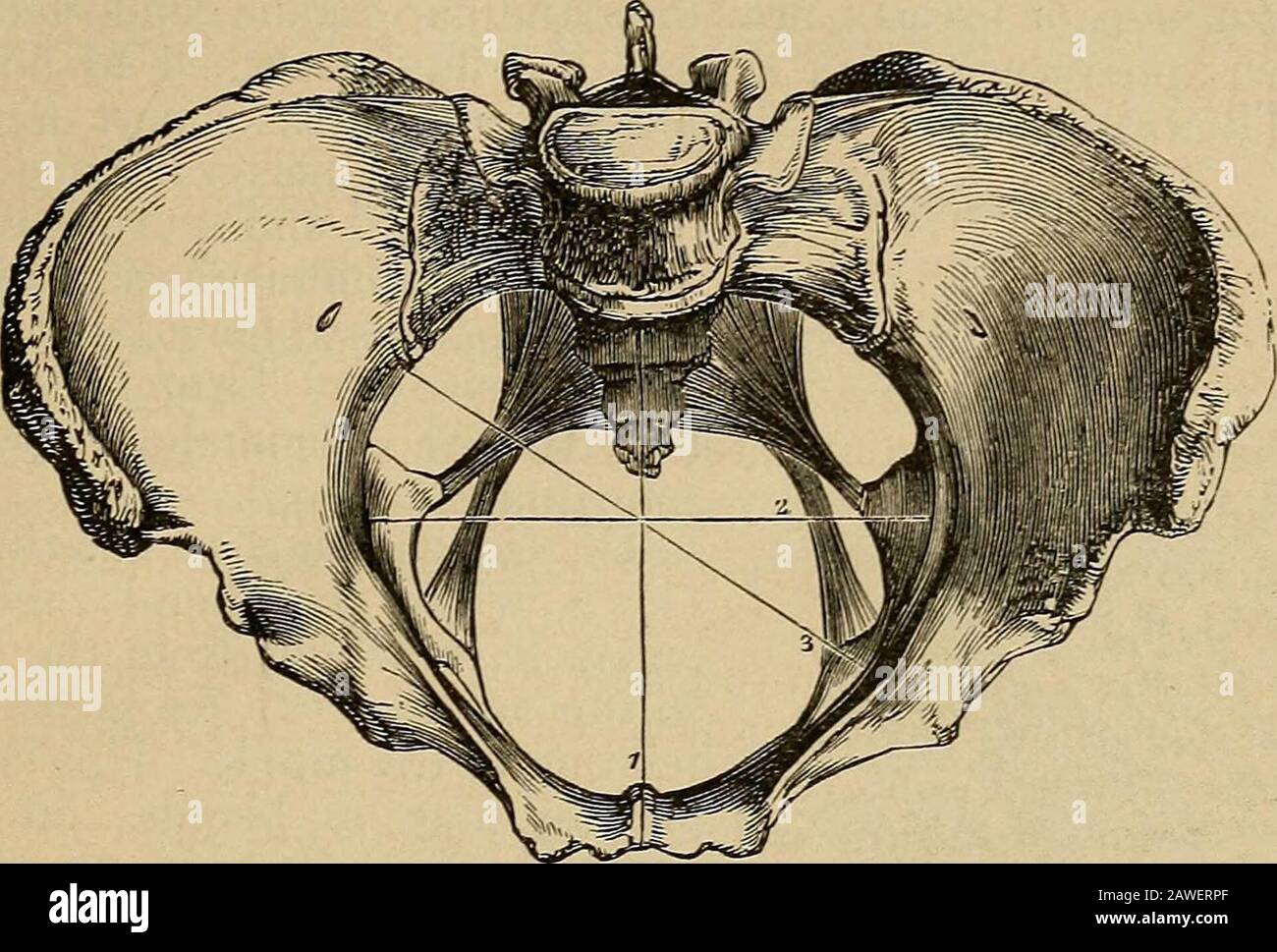 ObstetricsA manual for students and practitioners . the oblique; 3d ...