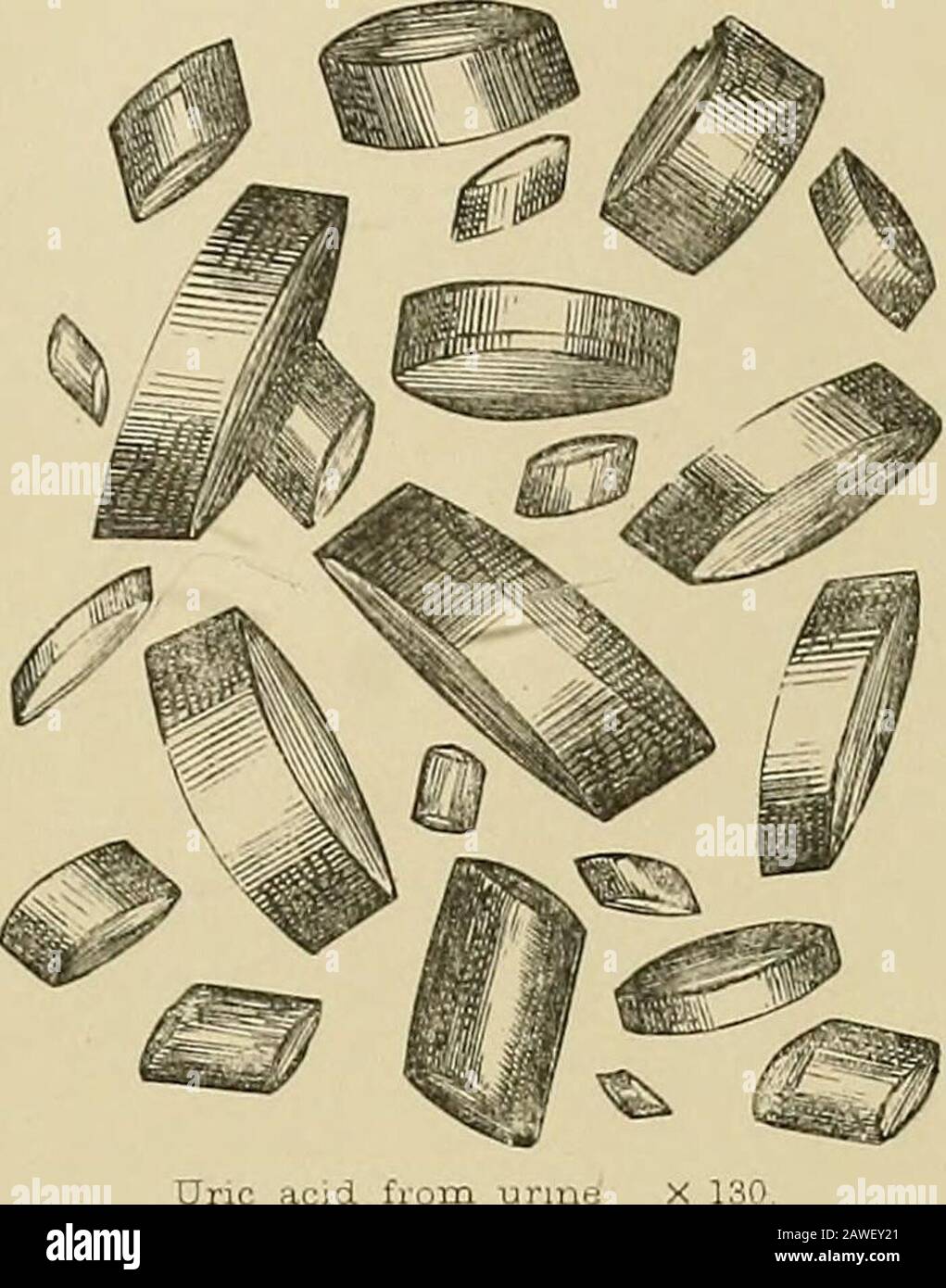 Kidney diseases, urinary deposits, and calculous disorders : their ...