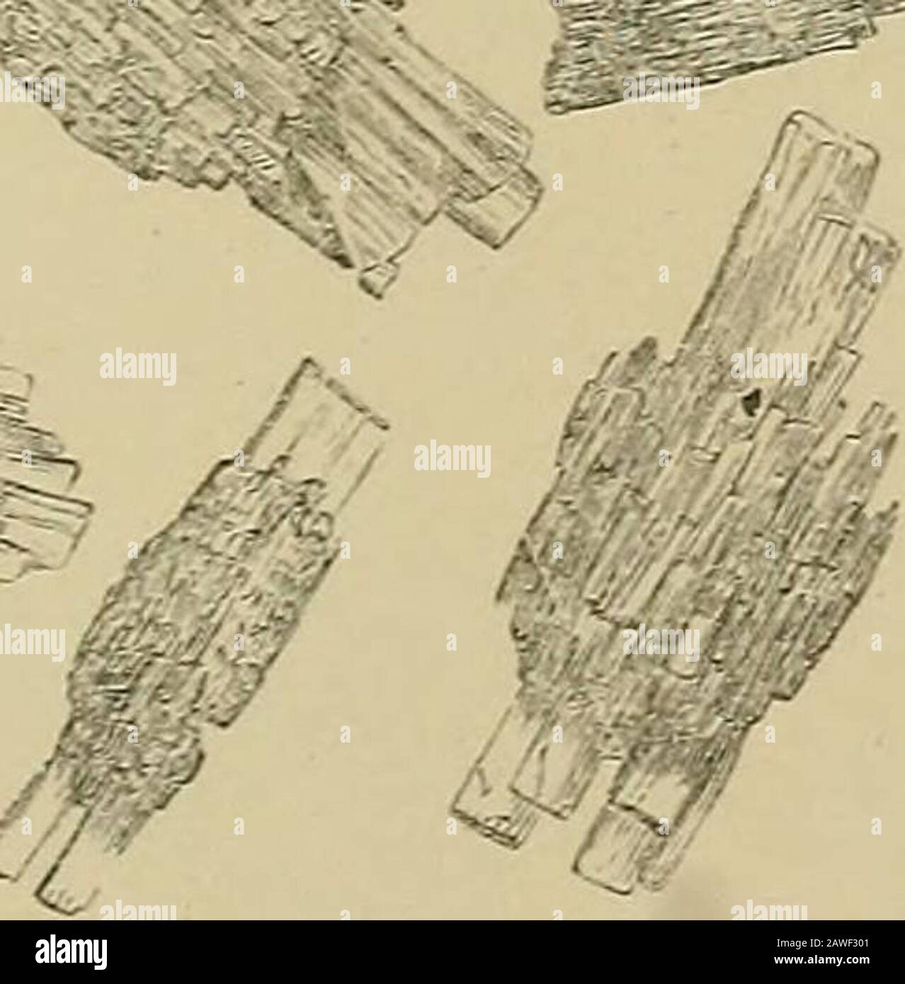 Kidney diseases, urinary deposits, and calculous disorders : their ...