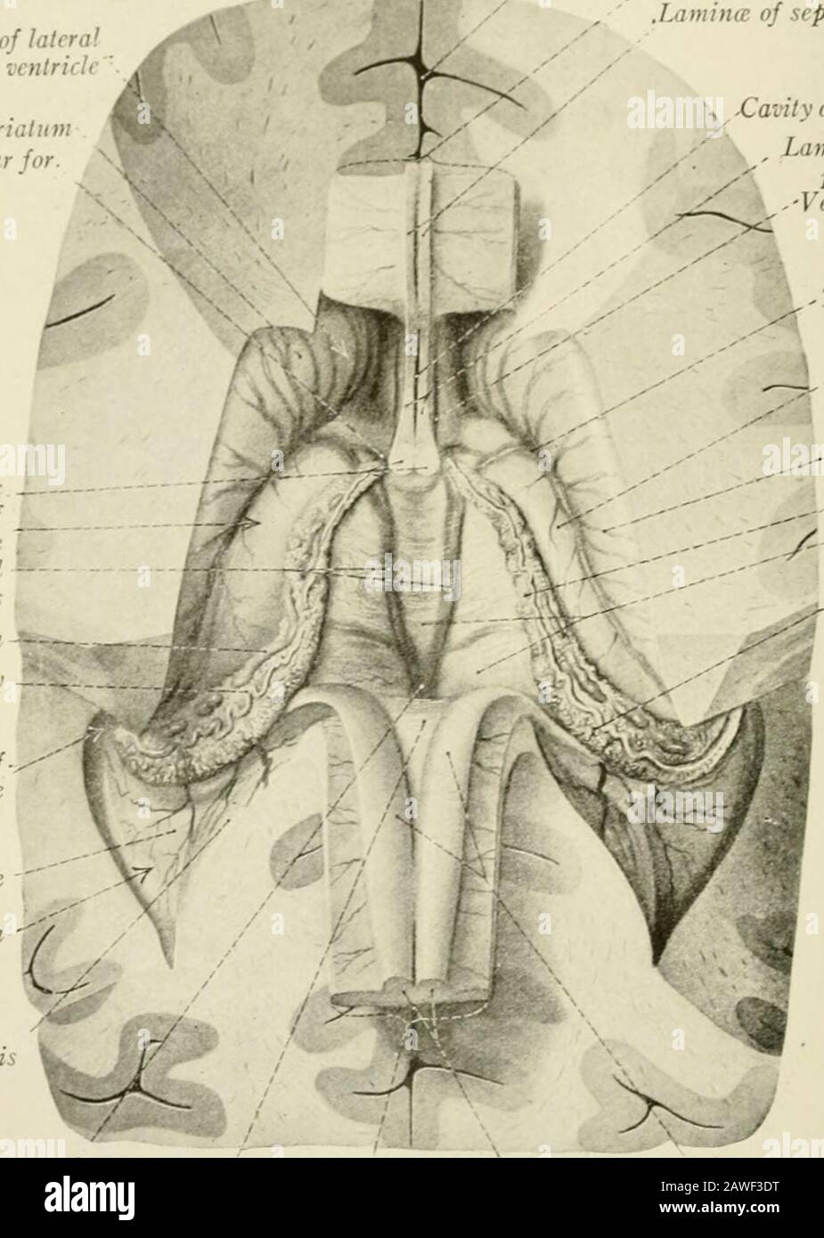 Interventricular foramen hi-res stock photography and images - Alamy