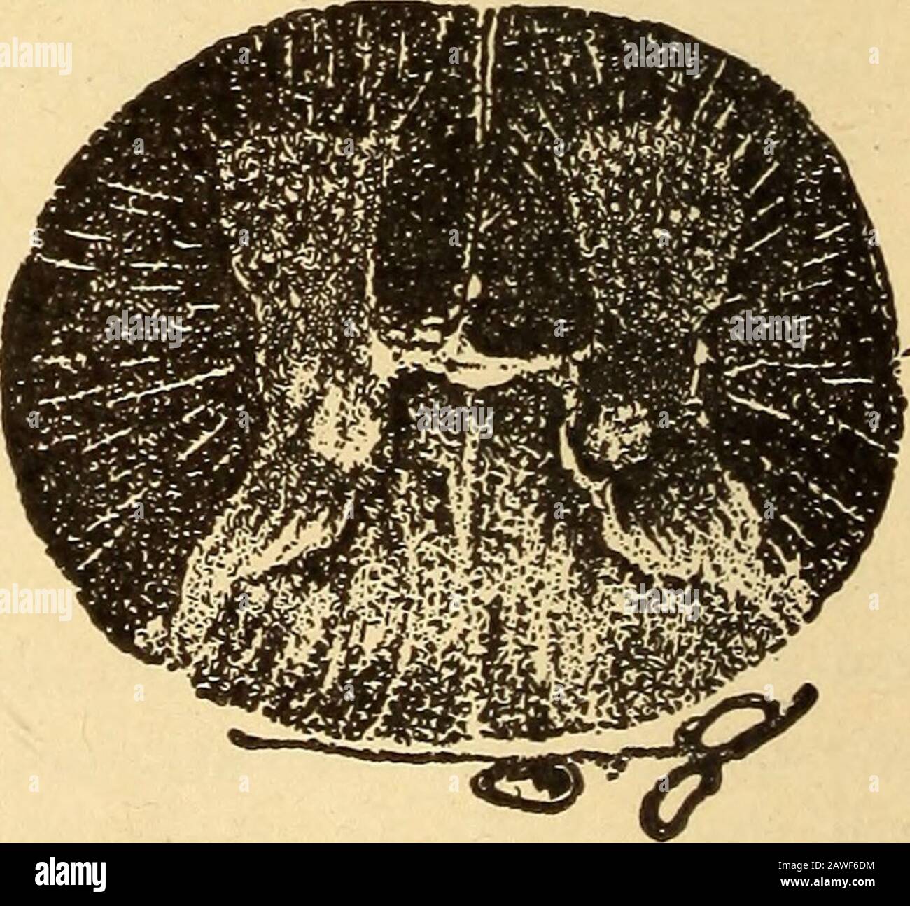 Diseases of the nervous system .. . Fig. 103.—^Tabetic Disease of the ...