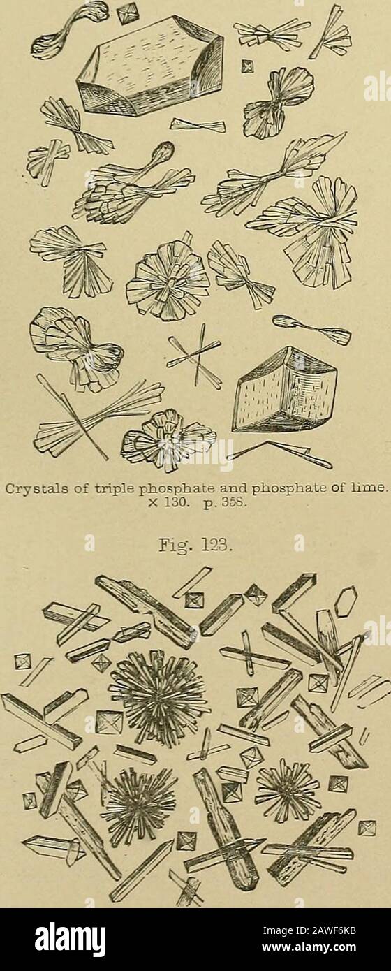 Kidney diseases, urinary deposits, and calculous disorders : their ...