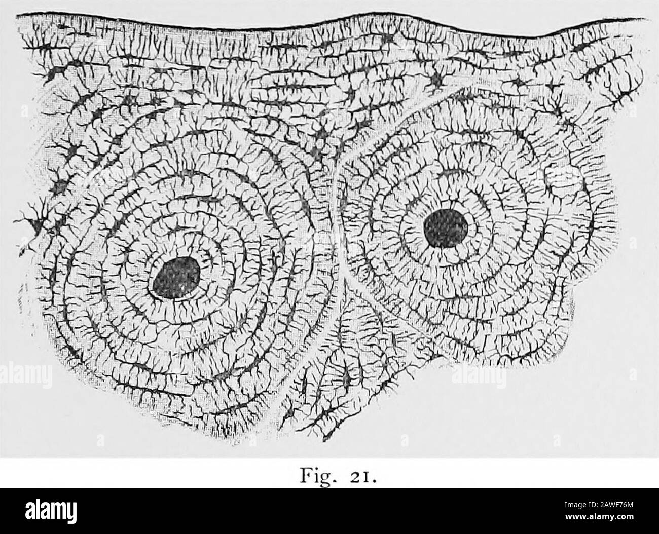 Haversian Black and White Stock Photos & Images - Alamy