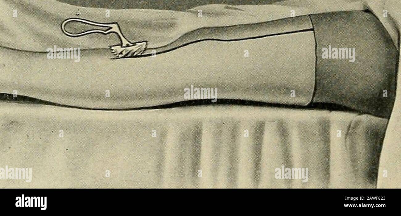 The operating room and the patient; a manual of pre- and post-operative ...