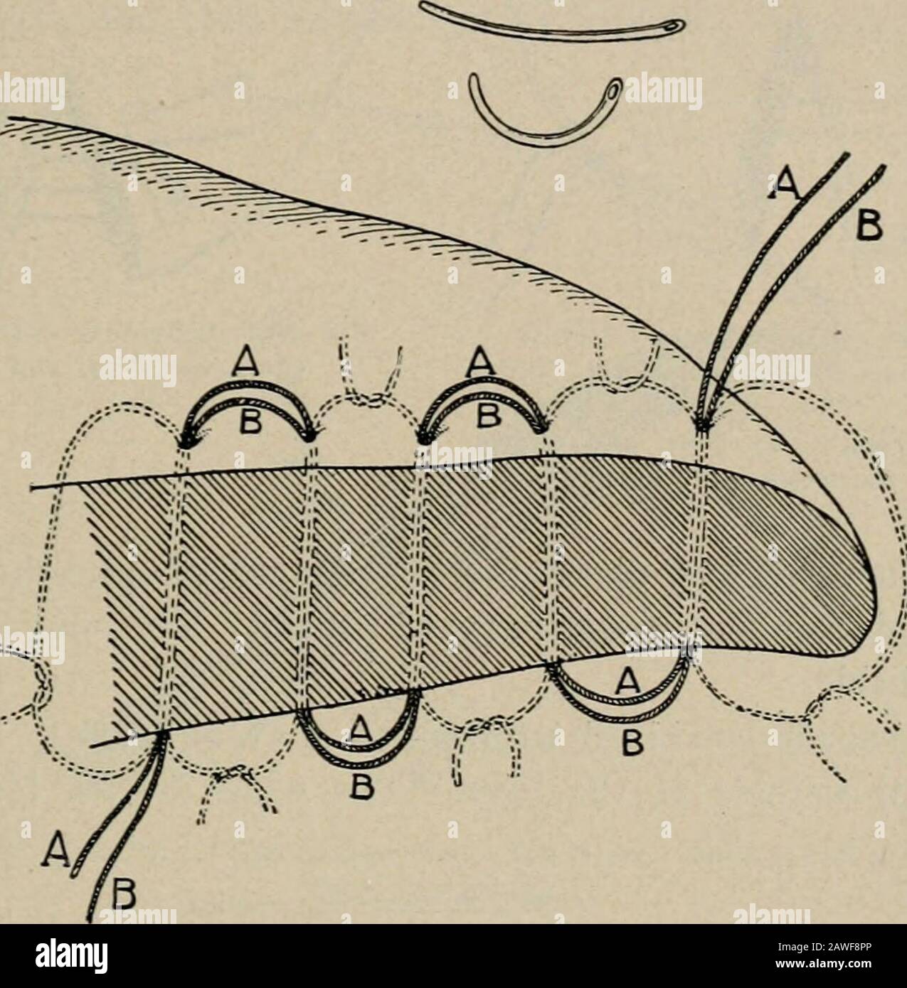 Operative surgery, for students and practitioners . placed well beyond ...