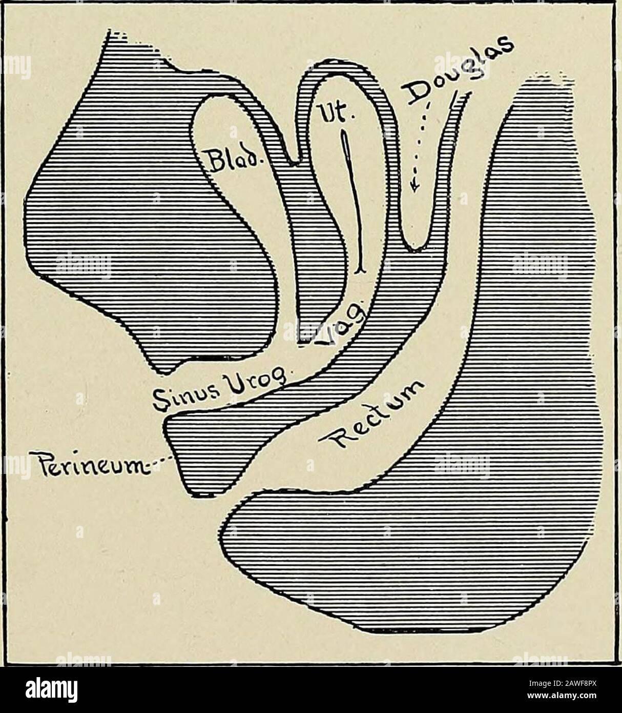 Urogenital Sinus