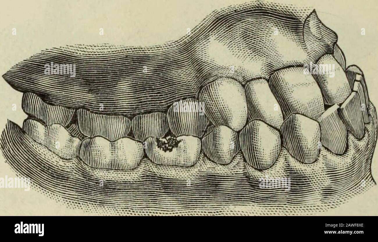 Clasp retained hi-res stock photography and images - Alamy