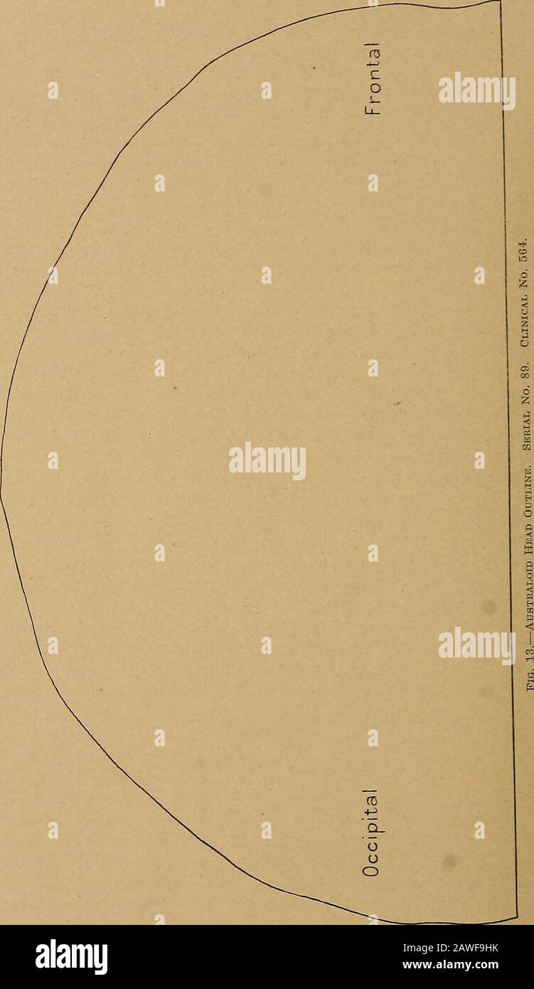 Australoid hi-res stock photography and images - Alamy