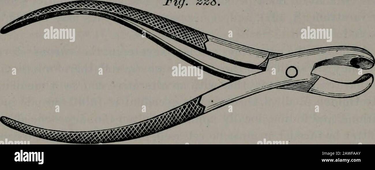 Carious process hi-res stock photography and images - Alamy