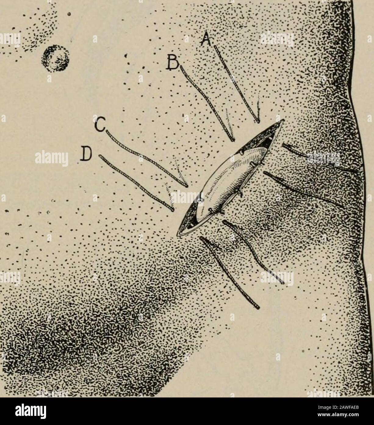 Operative surgery, for students and practitioners . art of the incision ...