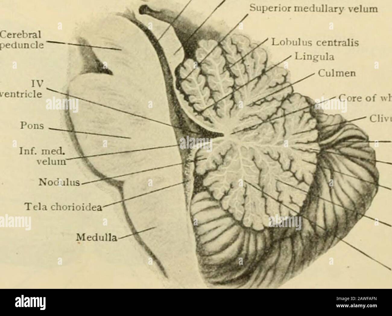 Vallecula Diagram